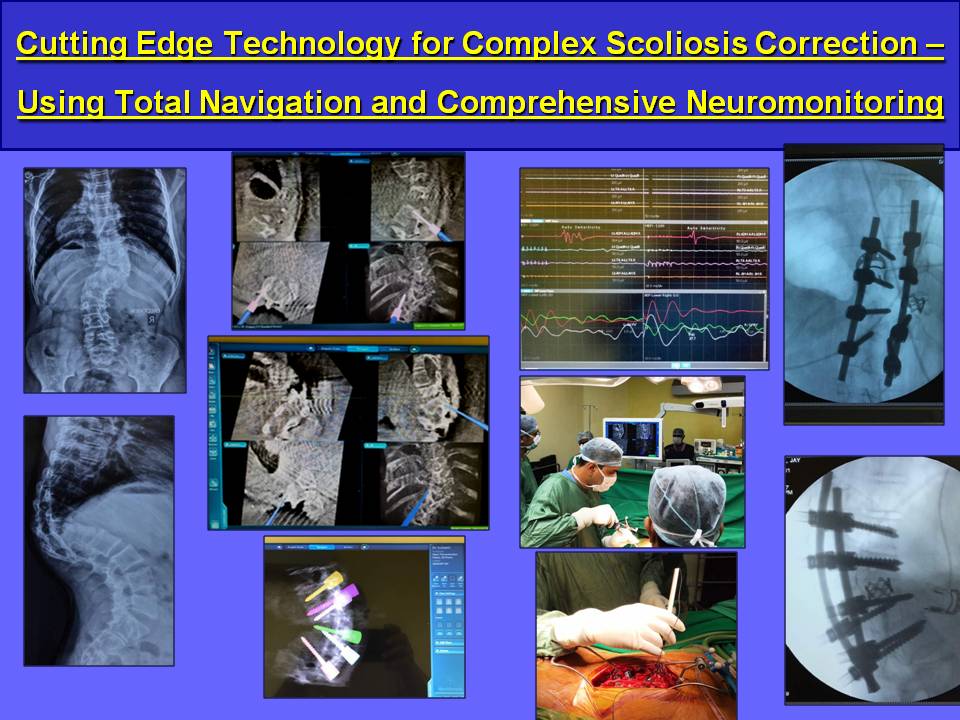Best Spine Surgery hospital, Spine Surgeon in Mumbai, India.